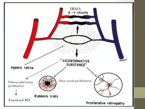 Diabetic Retinopathy Treatment at IClinix - Advanced Eye And Retina Center